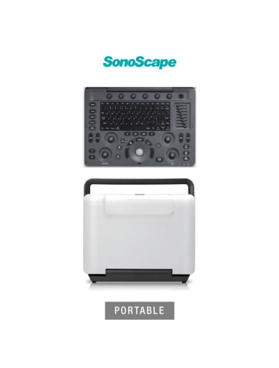 SonoScape E2 Portable Ultrasound Machine | Bionexmed