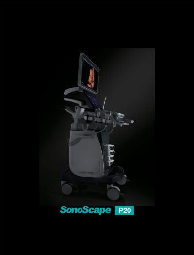 SonoScape P20 Ultrasound Machine | Value and Significance | Bionexmed