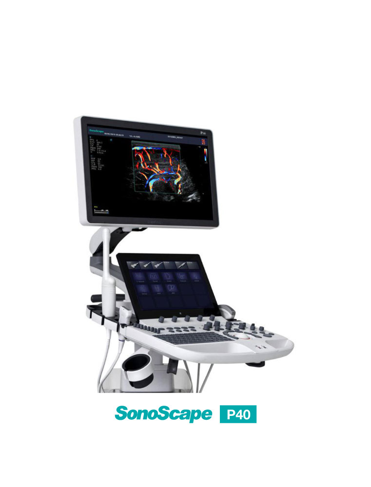 SonoScape P40 Ultrasound System - Precision Perfects Performance