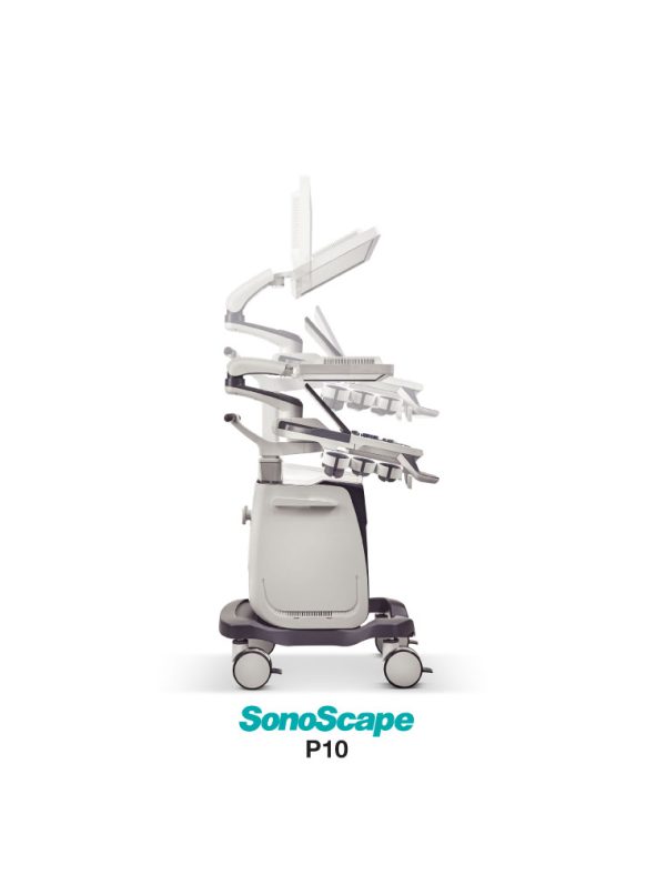 SonoScape P10 Ultrasound Machine | Flexible Imaging Solutions | Bionexmed