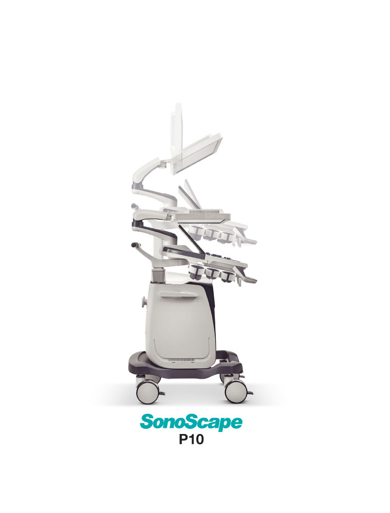 SonoScape P10 Ultrasound Machine | Flexible Imaging Solutions | Bionexmed