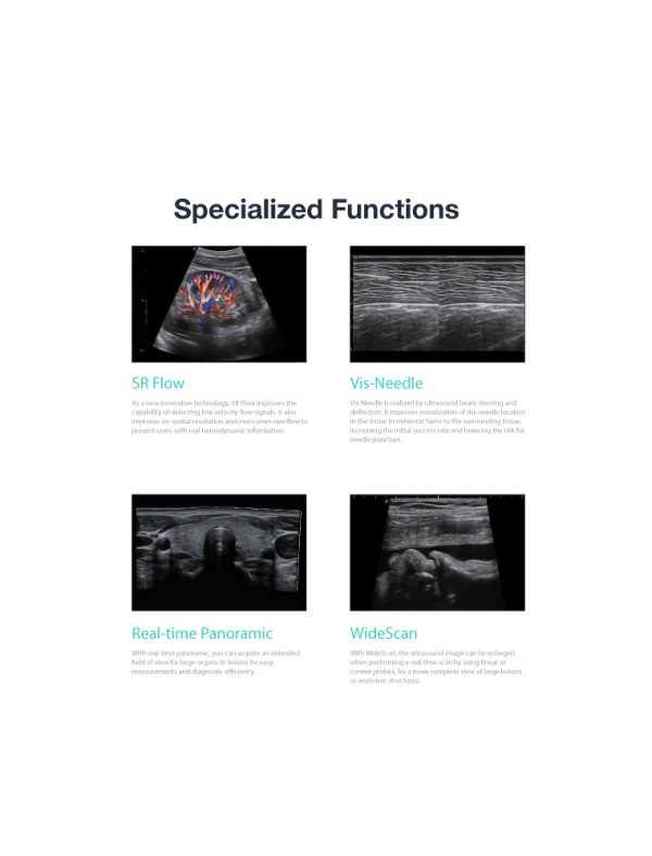 SonoScape P10 Ultrasound Machine | Flexible Imaging Solutions | Bionexmed