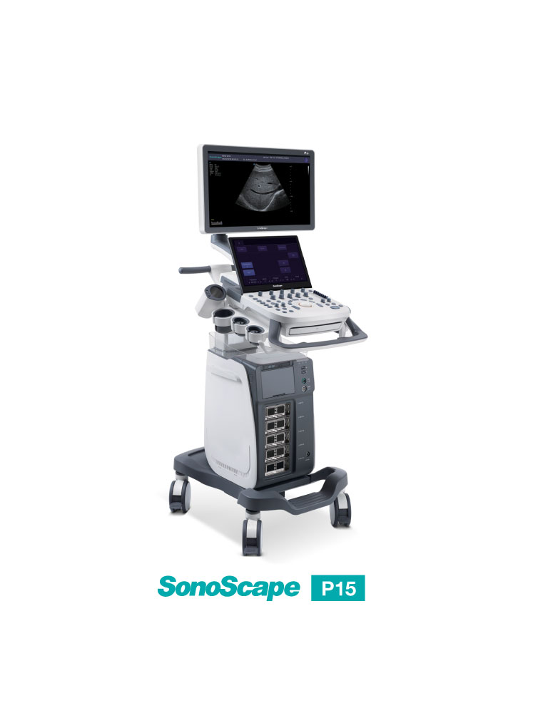 SonoScape P15 Ultrasound Machine | Enhance Your Ultrasound Exams ...
