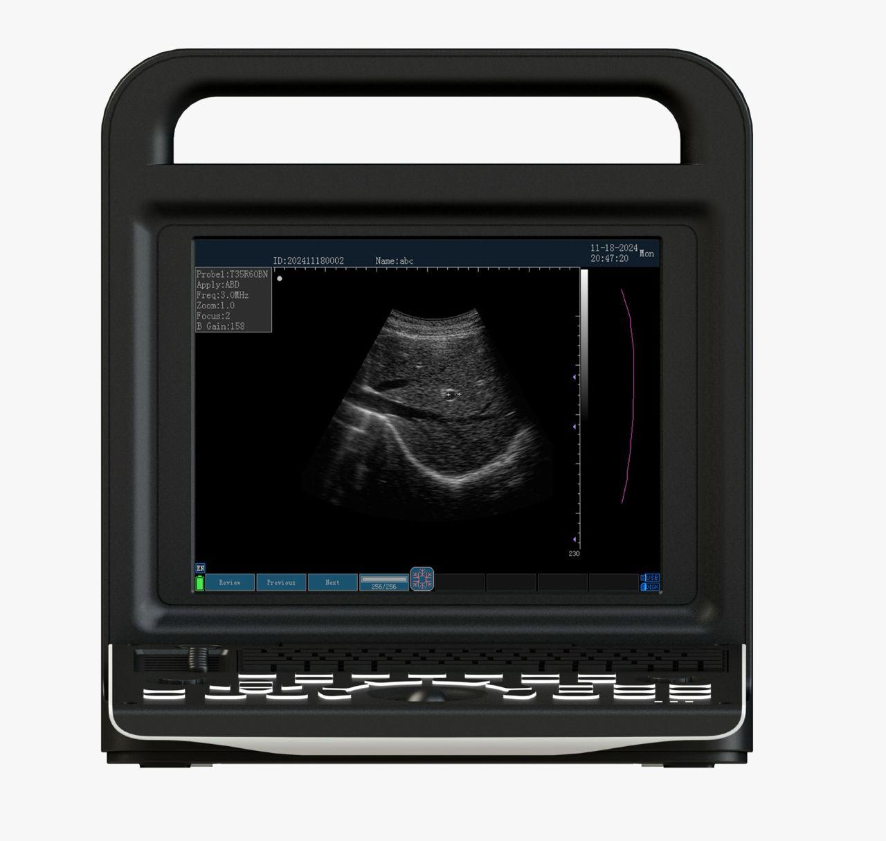 Portable Full Digital Ultrasound Machine C-90